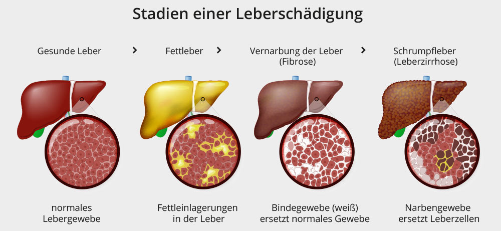 Die Leber – ein wahres Multifunktionsorgan - Blog podo medi
